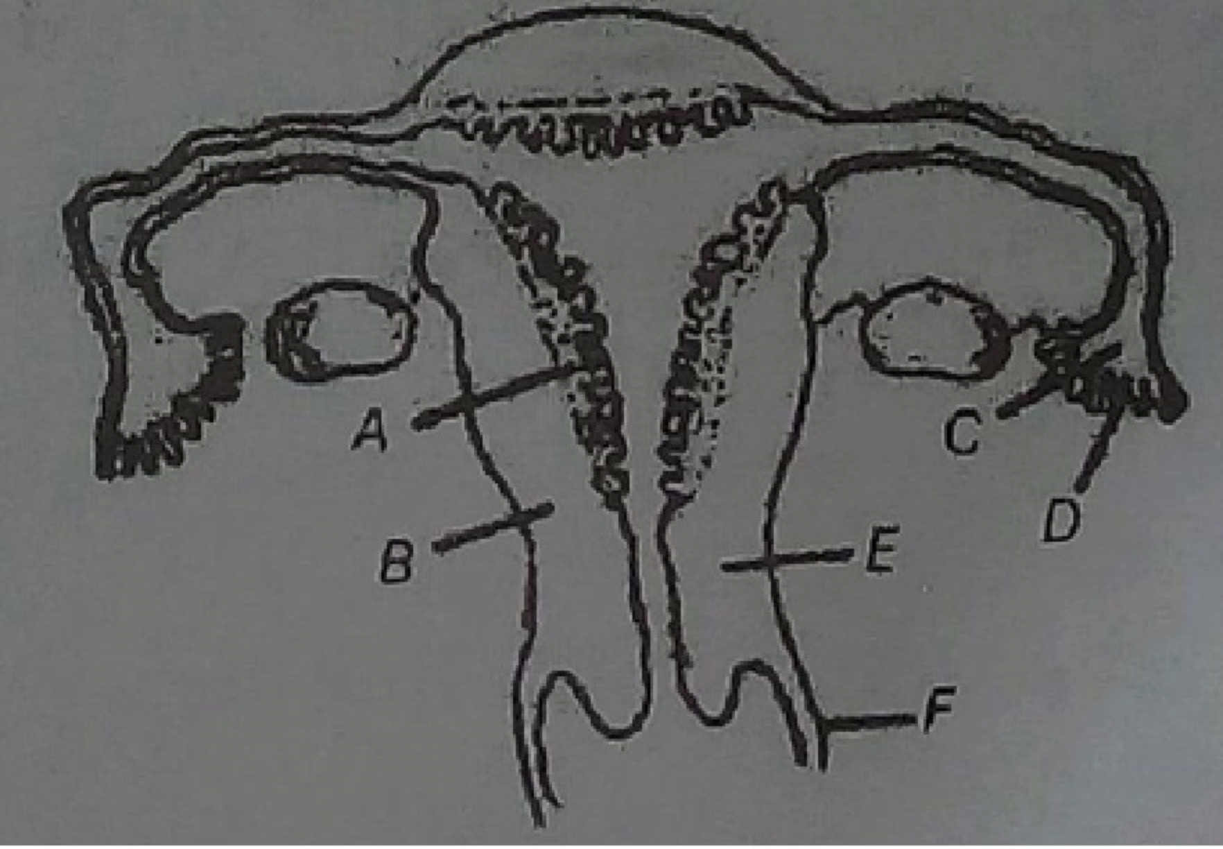 The figure given below depicts a diagrammatic sectional view of the ...